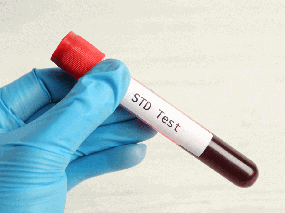 Over One Million People Infected With STDs Every Day –WHO - Latest ...